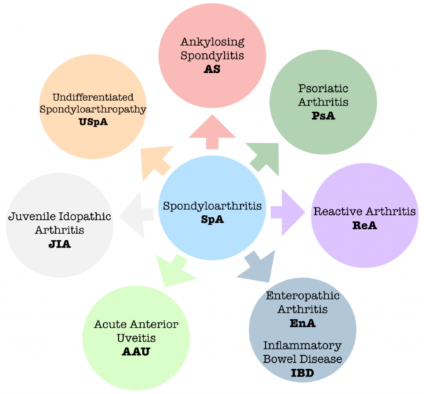 Spondyloarthritis decoded: types, symptoms and remedies - Angyline - EU ...